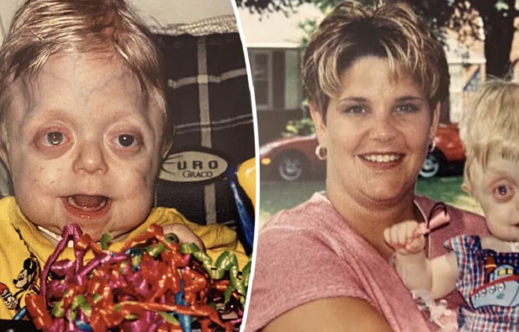 Teen who wasn’t expected to live past 18 months graduates high school ...
