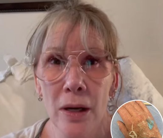 Melissa Gilbert Hospitalized After Bug Bite Turns Serious ...