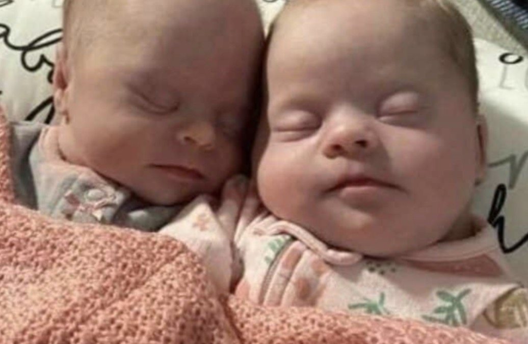 Florida woman gives birth to rare set of identical twins with Down ...
