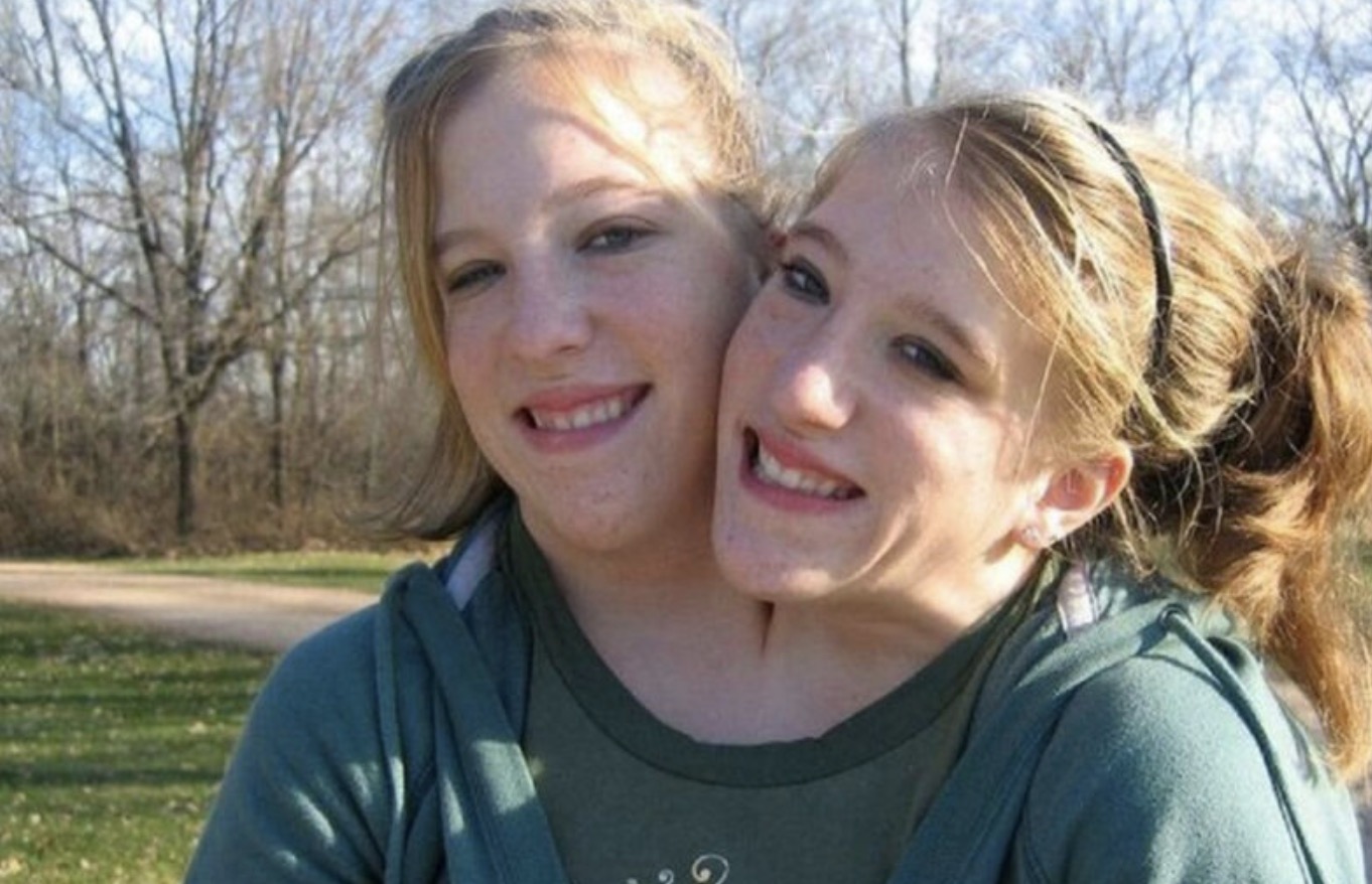 «One husband for two sisters!😱 Siamese twins revealed their wedding ...