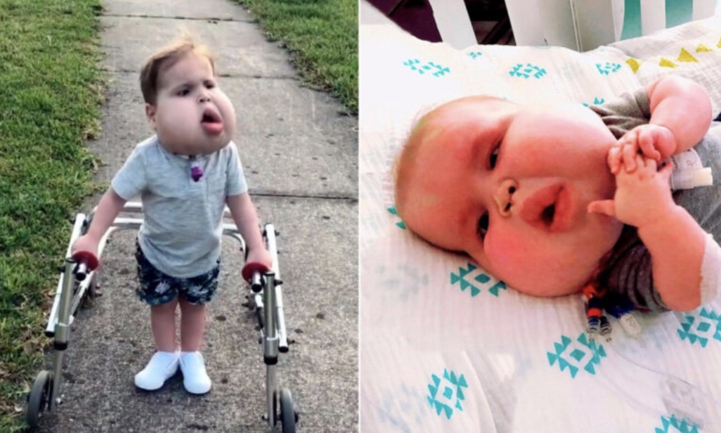 The Extraordinary Journey: Learn Gavin’s Remarkable Story From Birth to ...